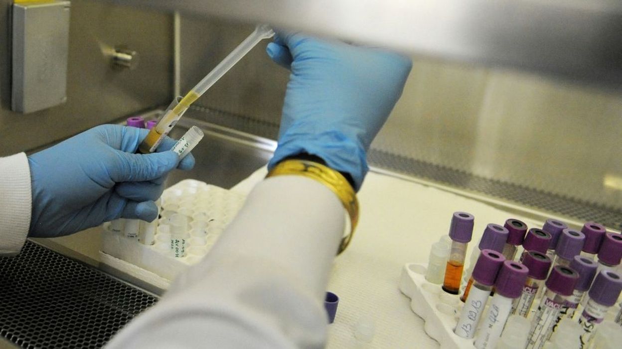 Un traitement préventif contre le virus du sida testé avec succès en ...