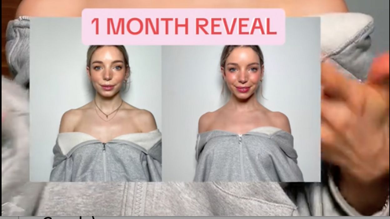 Le Barbie Botox, une intervention esthétique loin d'être anodine - RTBF ...