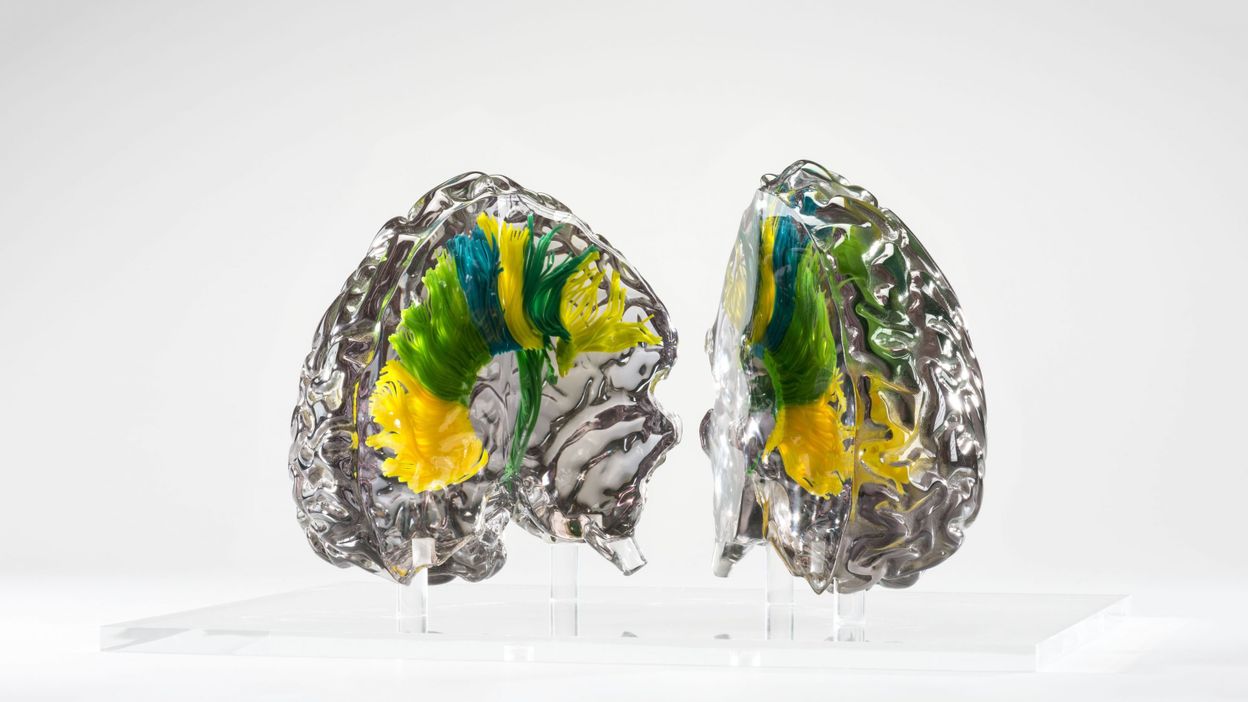 Le 'cerveau de Vésale', lien entre passé et avenir de la médecine, au ...