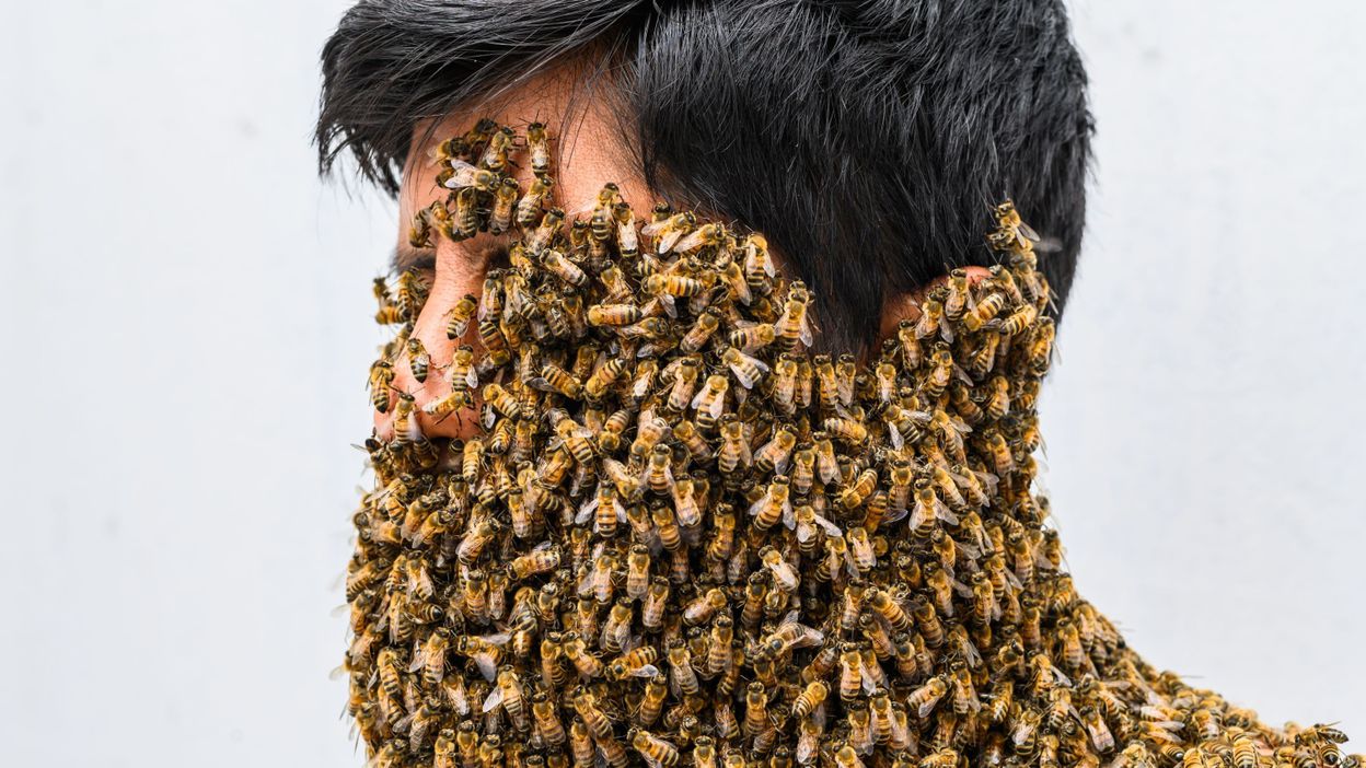 Piqûres d’insecte : comment savoir si je fais une réaction normale ou ...