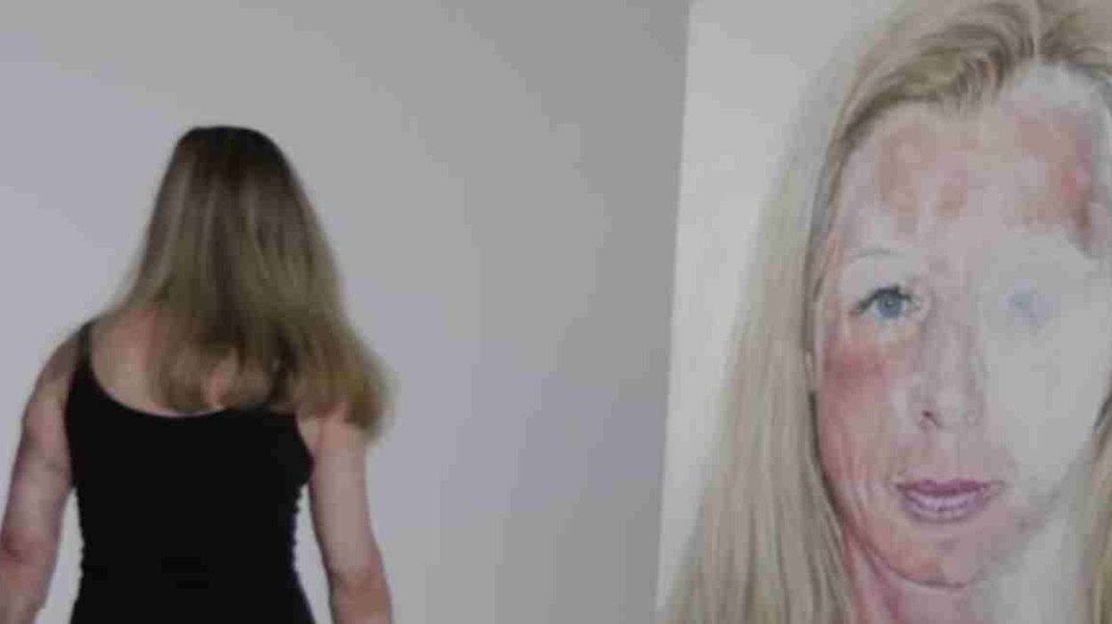 Richard Remes, le vitrioleur qui a défiguré Patricia Lefranc, en ...