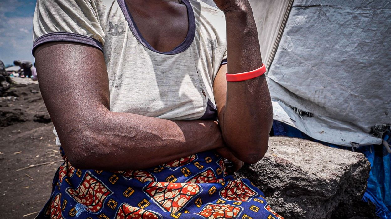 'Congo is bleeding': les Léopards profitent de la CAN pour dénoncer les ...