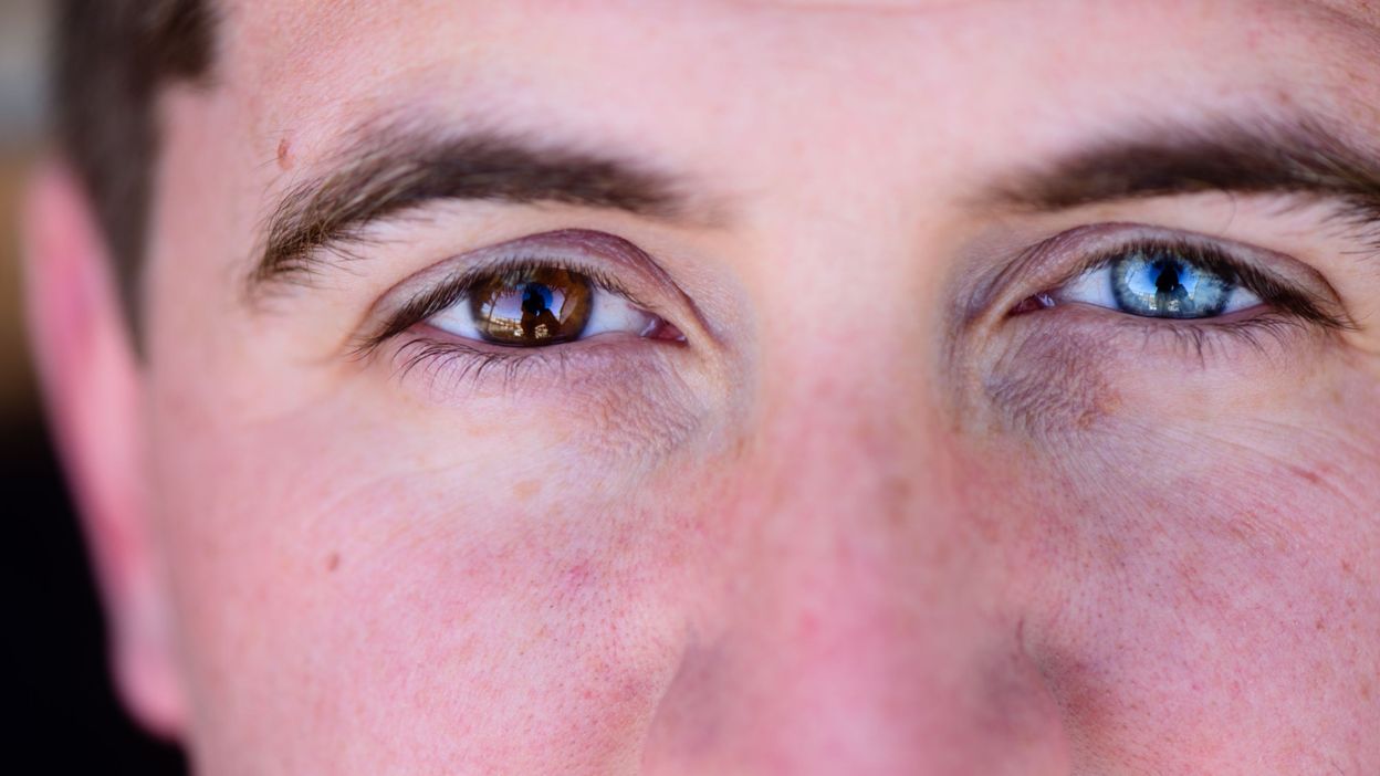Yeux vairons : quelle est l'origine de l'hétérochromie ? - RTBF Actus