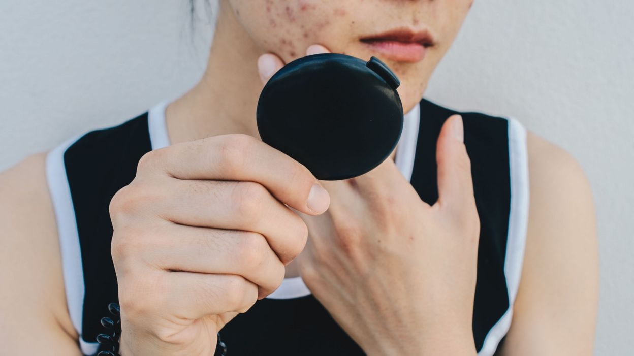 Pierres aux reins : 1 personne sur 10 est touchée par la lithiase ...