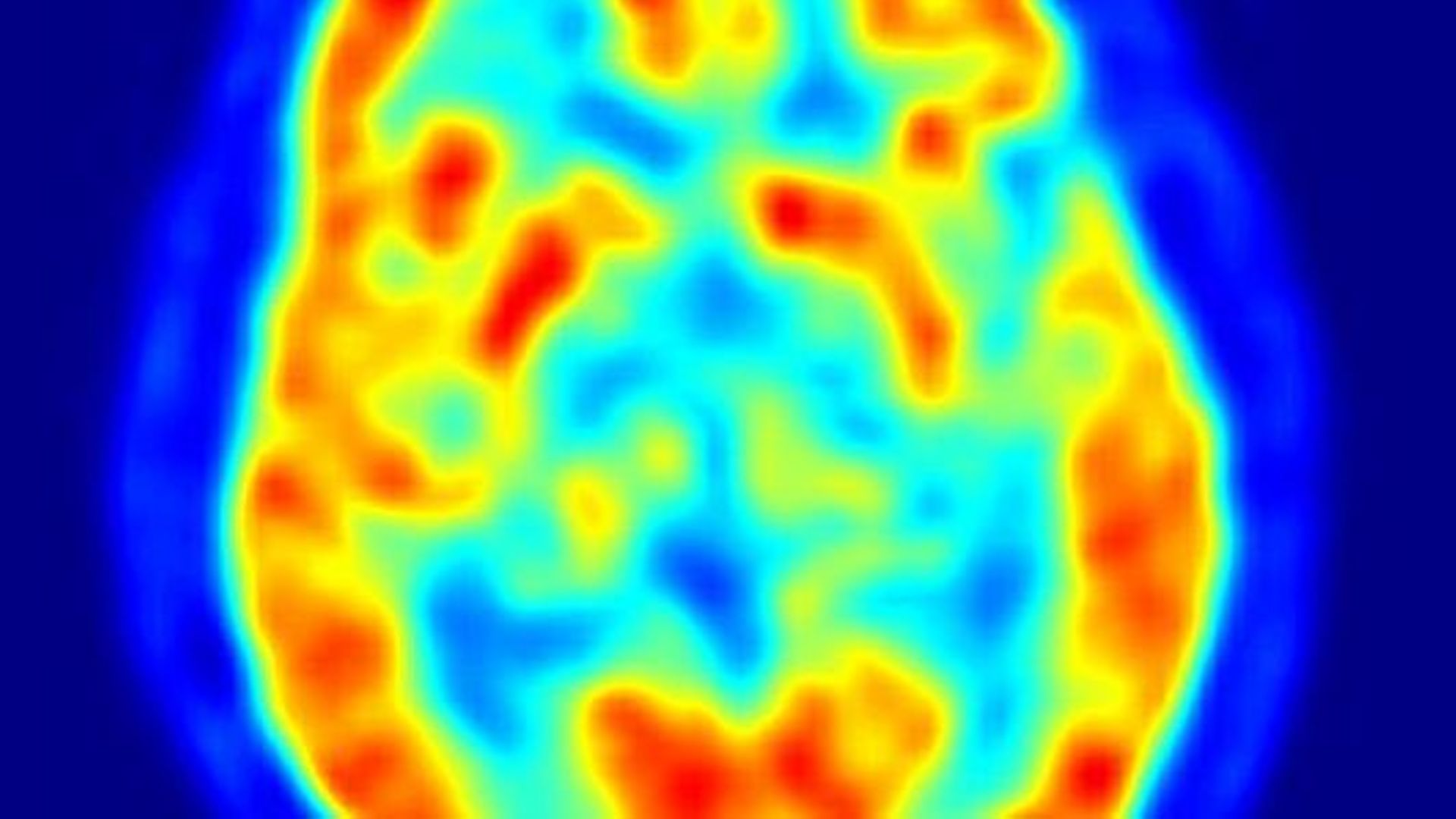 Que se passe-t-il dans le cerveau d'un enfant autiste ? - RTBF Actus