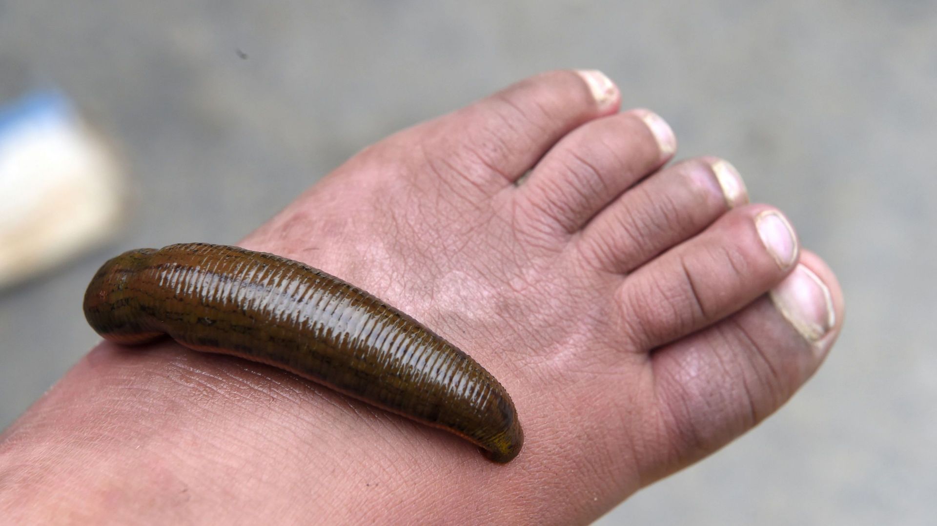 La sangsue, un animal peu attirant mais prisé dans les hôpitaux - RTBF ...