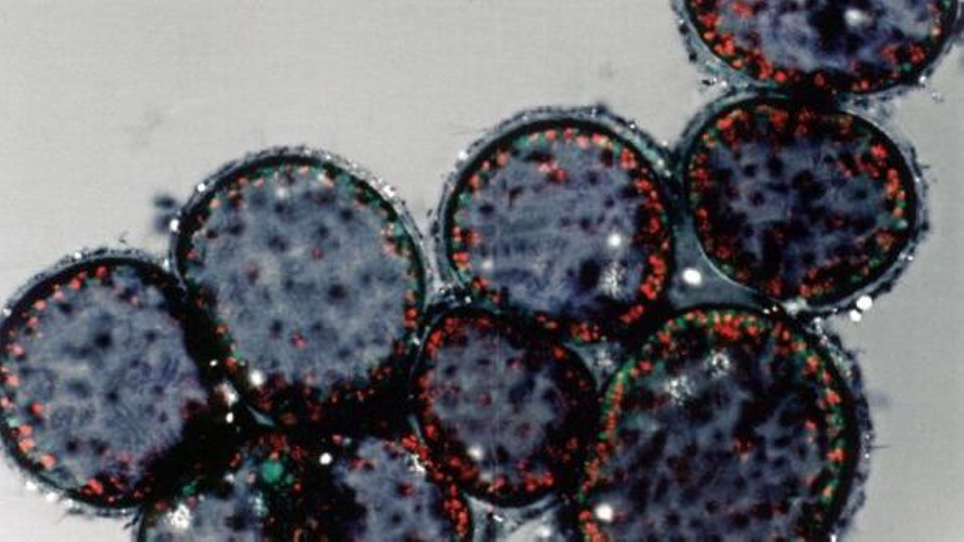 Plus de 10 000 sortes de microbes dans le corps humain - RTBF Actus