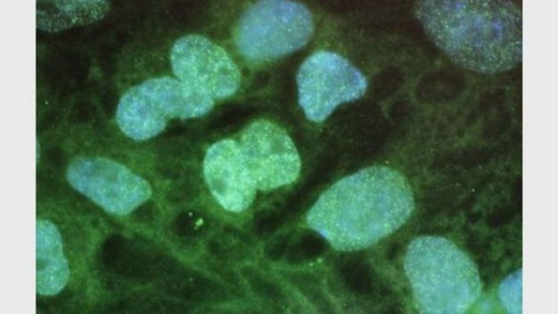 Don de cellules-souches : afflux des donneurs - RTBF Actus