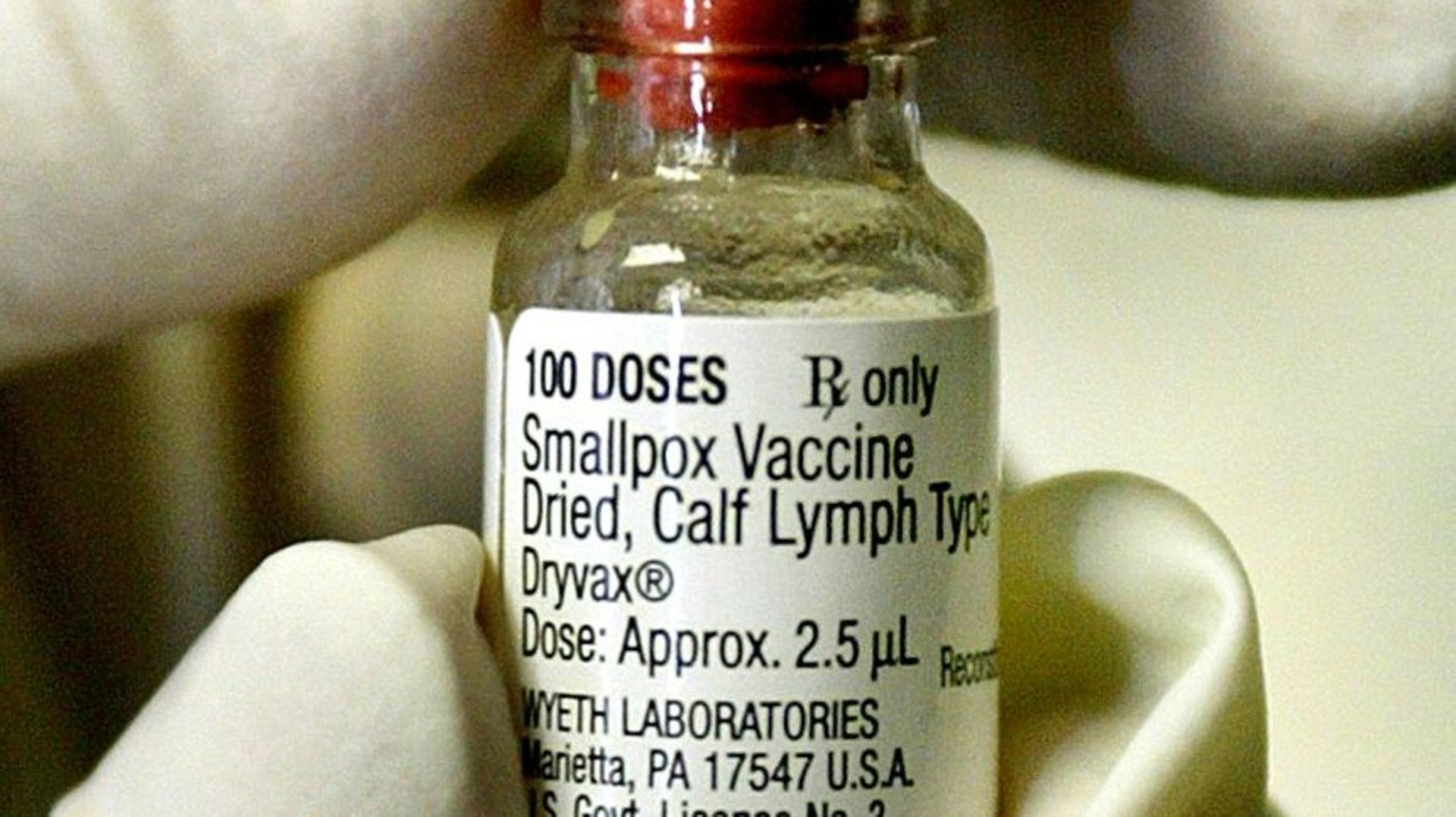 Découverte de l'ADN du plus ancien virus de la variole