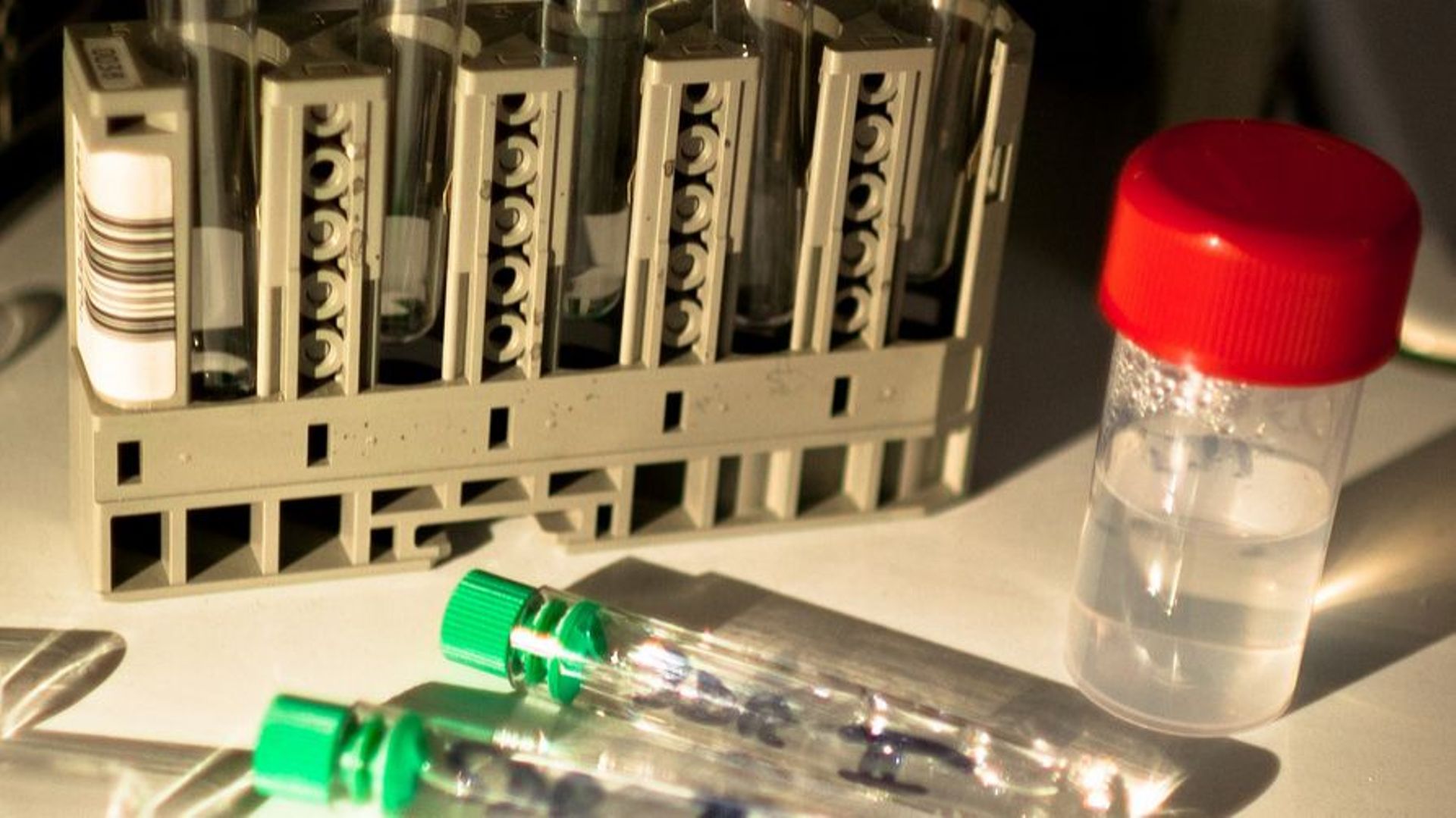 Développer sa biobanque pour mieux contrer le cancer