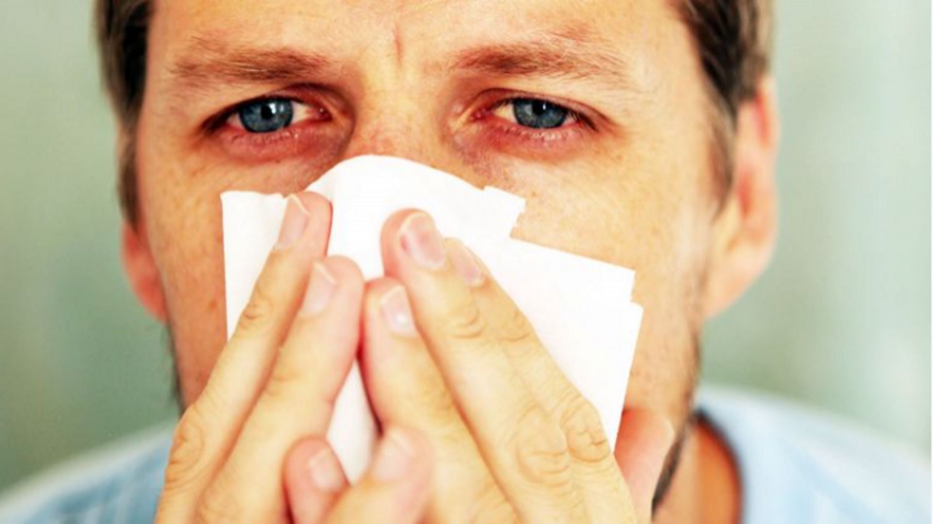 Conjonctivite : comment soigner cette inflammation de l'œil ? - RTBF Actus