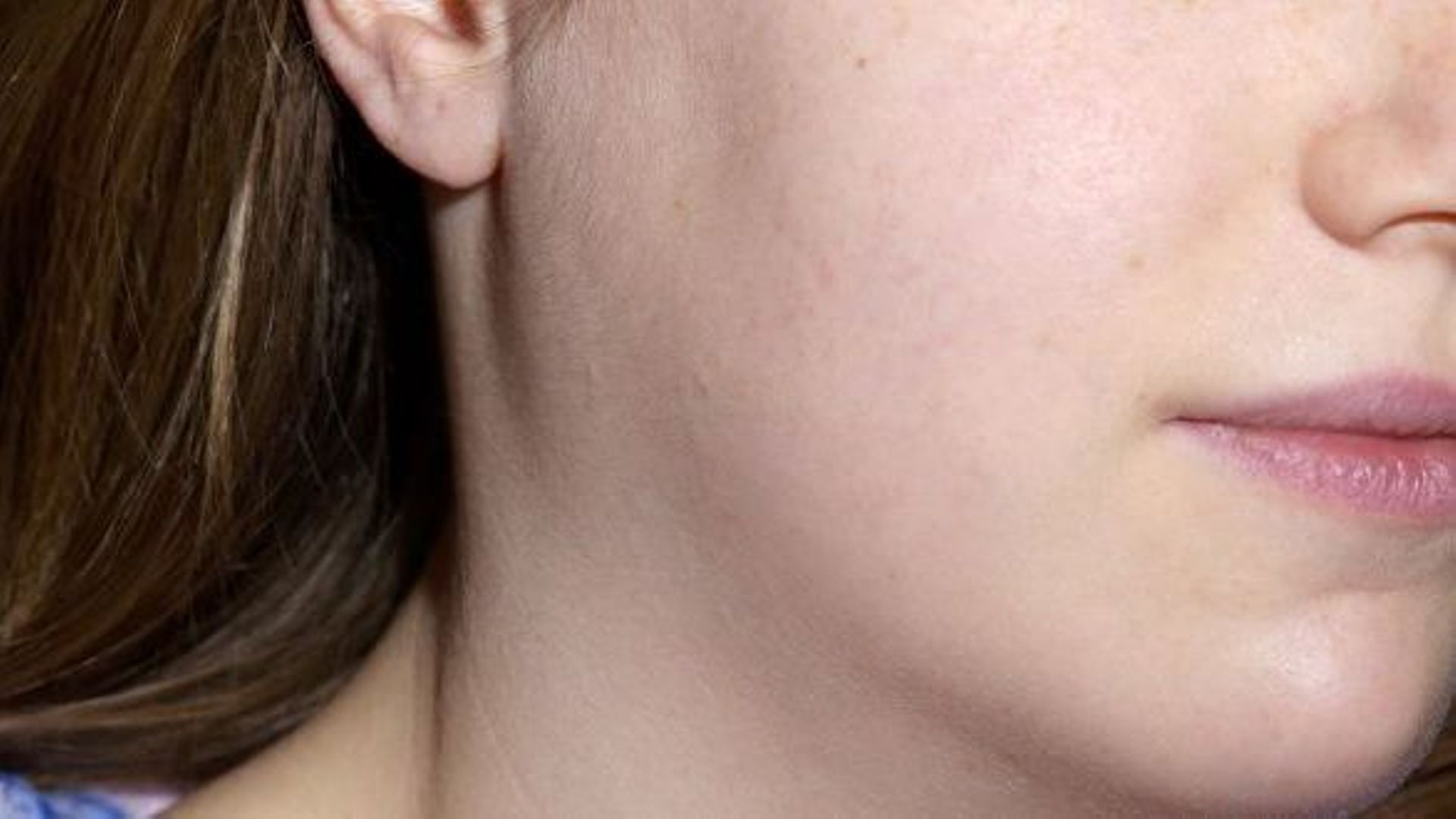 Le virus des oreillons s'étend en Flandre - RTBF Actus