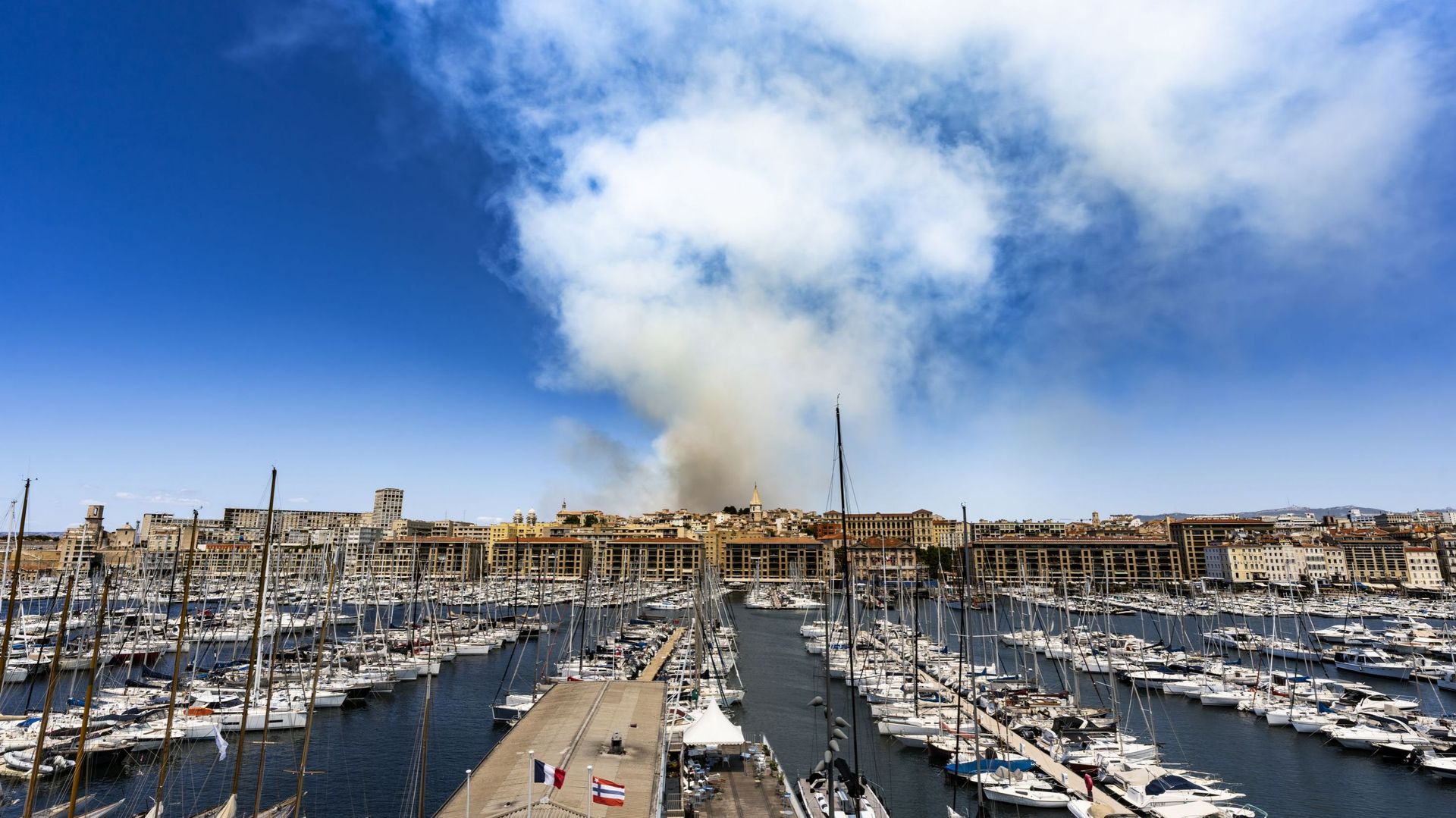 Paresthésie : que faire quand on a des picotements dans les pieds et à ...