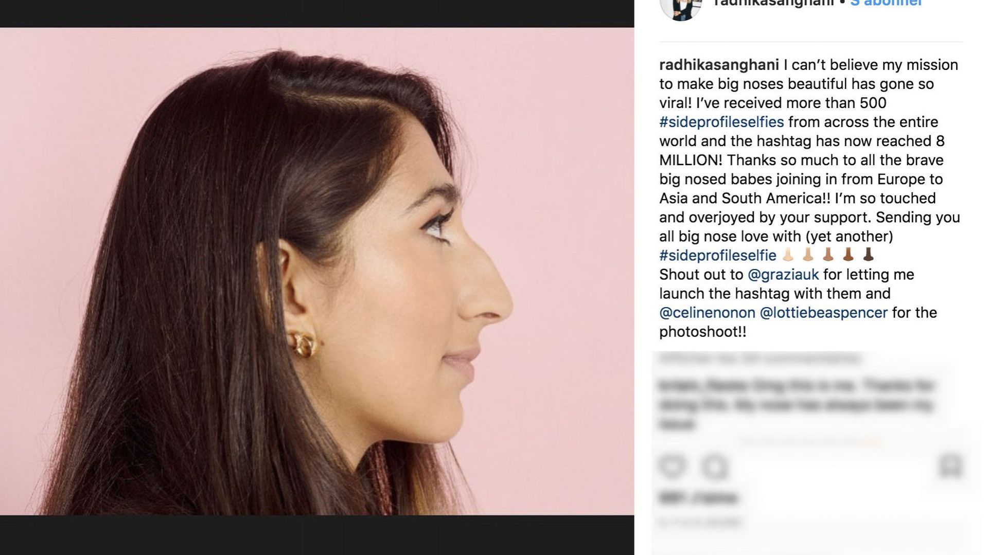 Acceptation de soi : de la beauté des grands nez - RTBF Actus