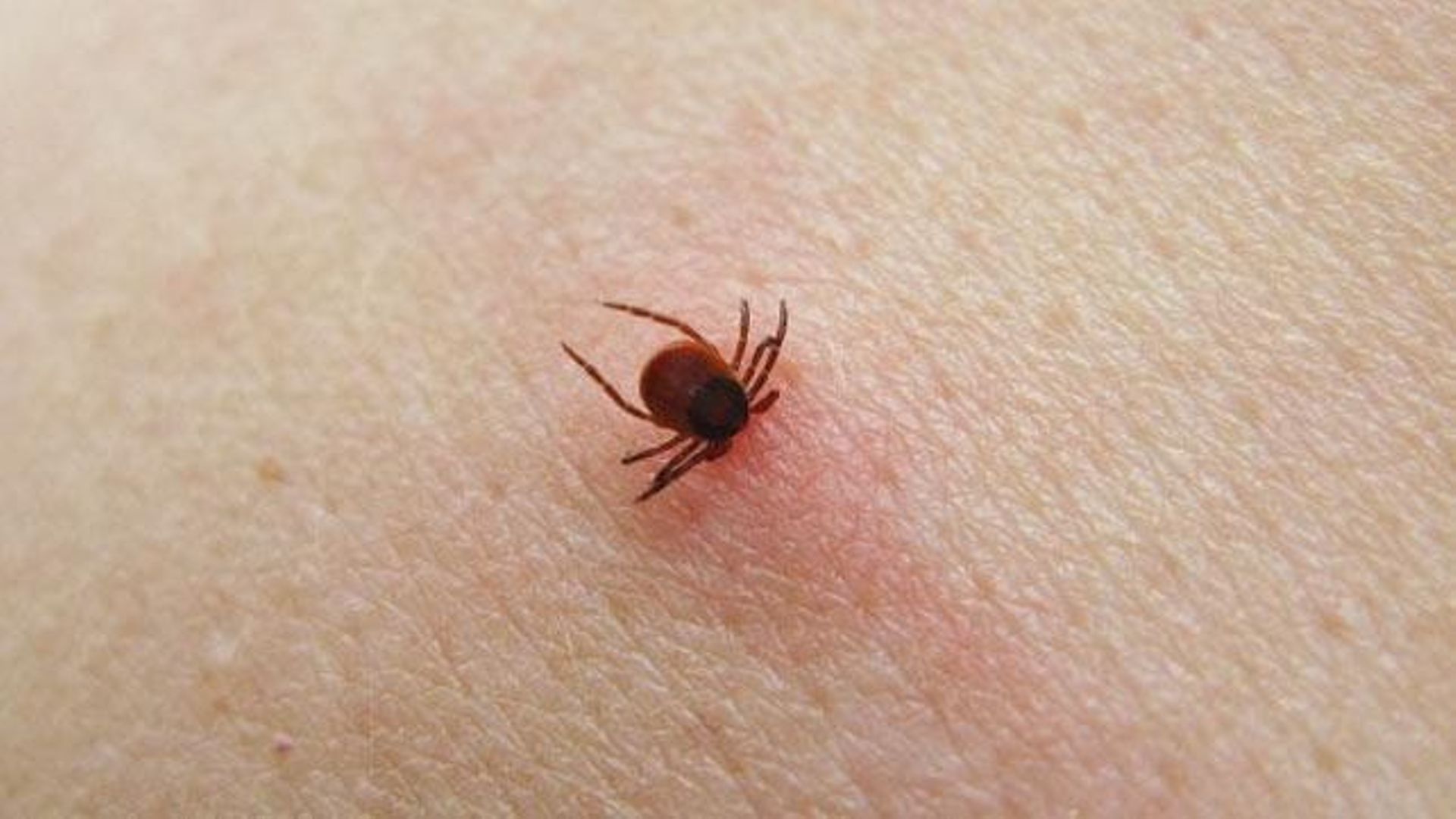 Tiques: quelles sont les zones les plus à risques en Belgique ? - RTBF ...