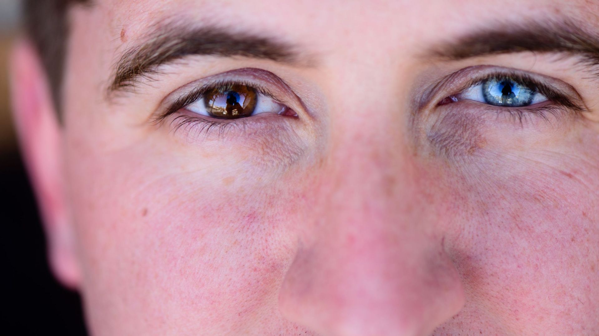 Comment expliquer les yeux vairons ? - RTBF Actus