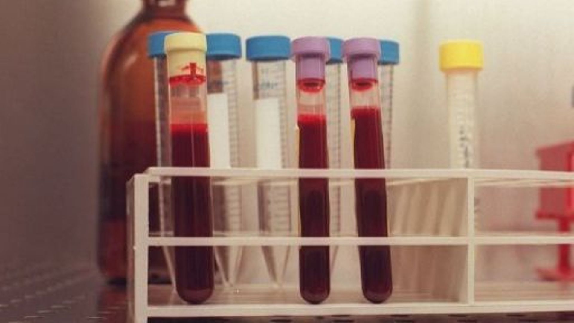 Sida: des traitements plus performants, à suivre plus tôt - RTBF Actus