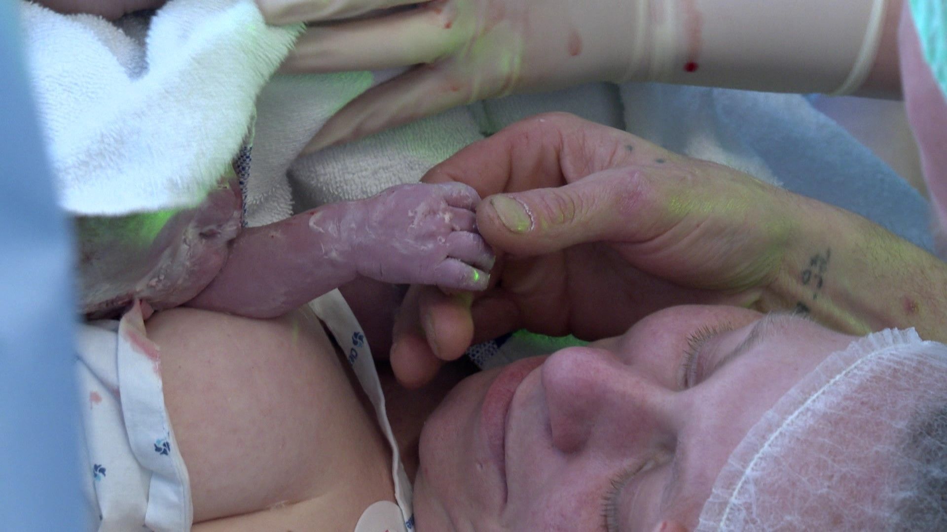 Des césariennes 'snoezelen' qui se rapprochent au maximum d’un accouchement classique - RTBF Actus