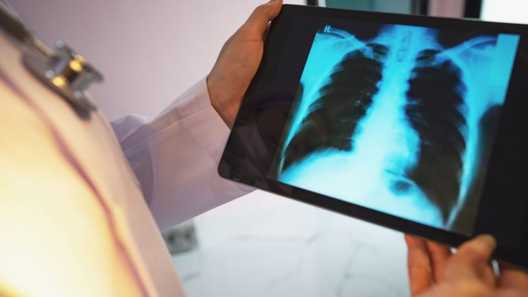 Fracture costale : comment soigner une fracture des côtes ? - RTBF Actus