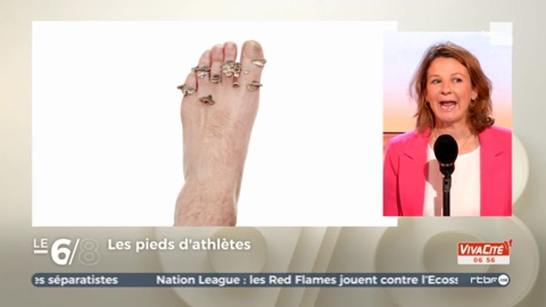 Comment différencier les brûlures du 1er, 2e ou 3e degré et les soigner ...
